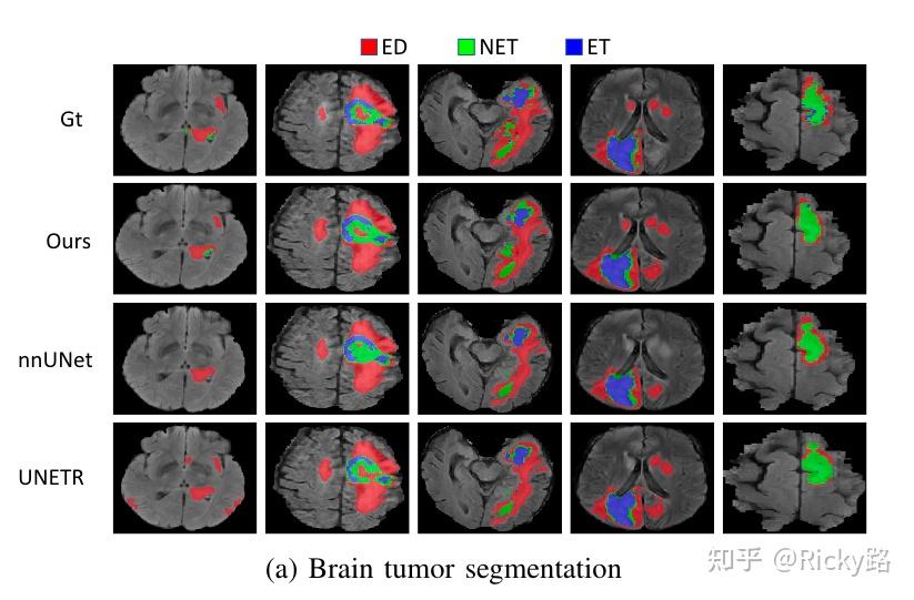 医学影像算法论文略知一二：nnFormer - 知乎