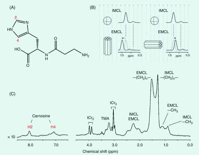活体磁共振波谱代谢物篇 - 知乎