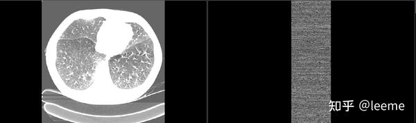 C++ dicom多平面重建MPR算法 - 知乎