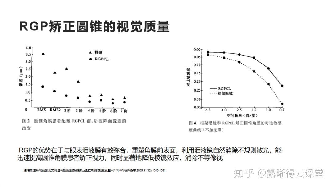 圆锥角膜的RGP验配及RGP临床效果分析（文字版） - 知乎