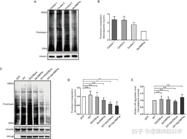 Ann Neurol︱福建医科大学附院陈万金/北京大学三院樊东升团队揭示SerRS基因杂合突变导致腓骨肌萎缩症 - 知乎