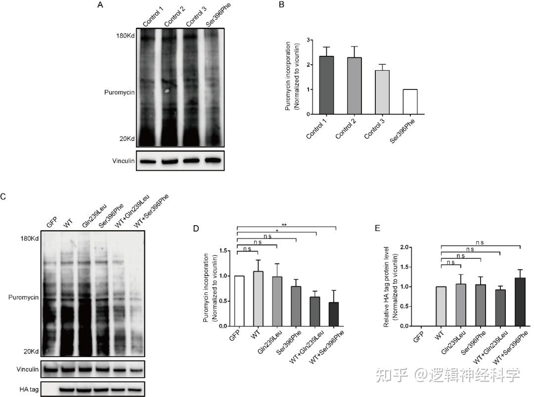Ann Neurol︱福建医科大学附院陈万金/北京大学三院樊东升团队揭示SerRS基因杂合突变导致腓骨肌萎缩症 - 知乎