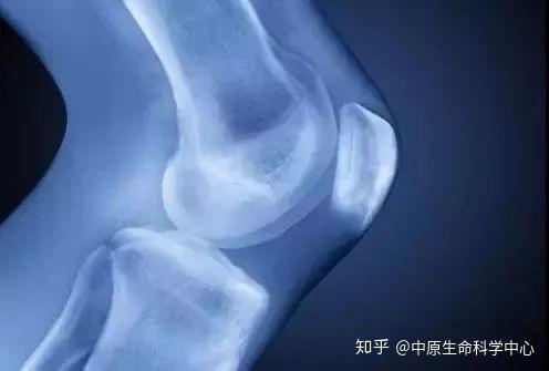 国内外大量临床研究数据证实，间充质干细胞治疗骨关节炎安全有效 - 知乎