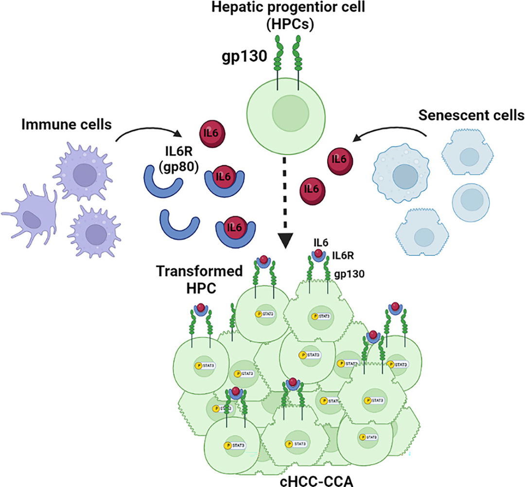 Journal. of Hepatology | 混合型肝细胞癌-胆管癌的起源与机制 - 知乎
