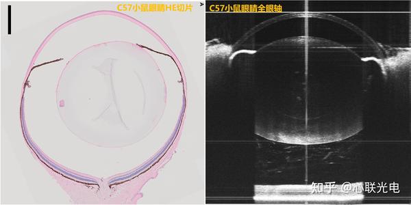 小动物眼轴及前节oct一体化成像系统 - 知乎