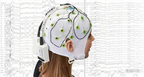 多模态神经成像之EEG-fMRI同步 - 知乎