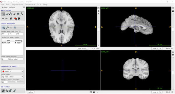 [论文笔记] VoxelMorph - 知乎