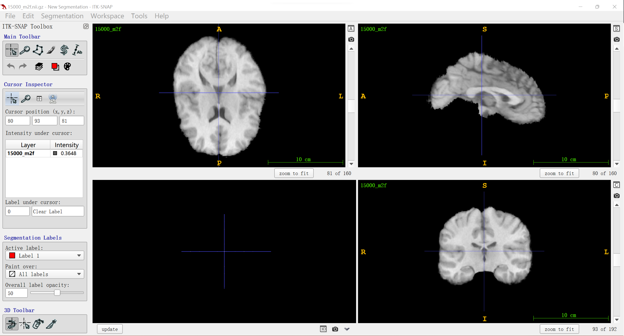 [论文笔记] VoxelMorph - 知乎
