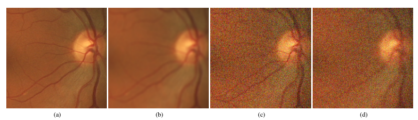 HRF Image Quality Assessment Dataset 数据集介绍 - 知乎