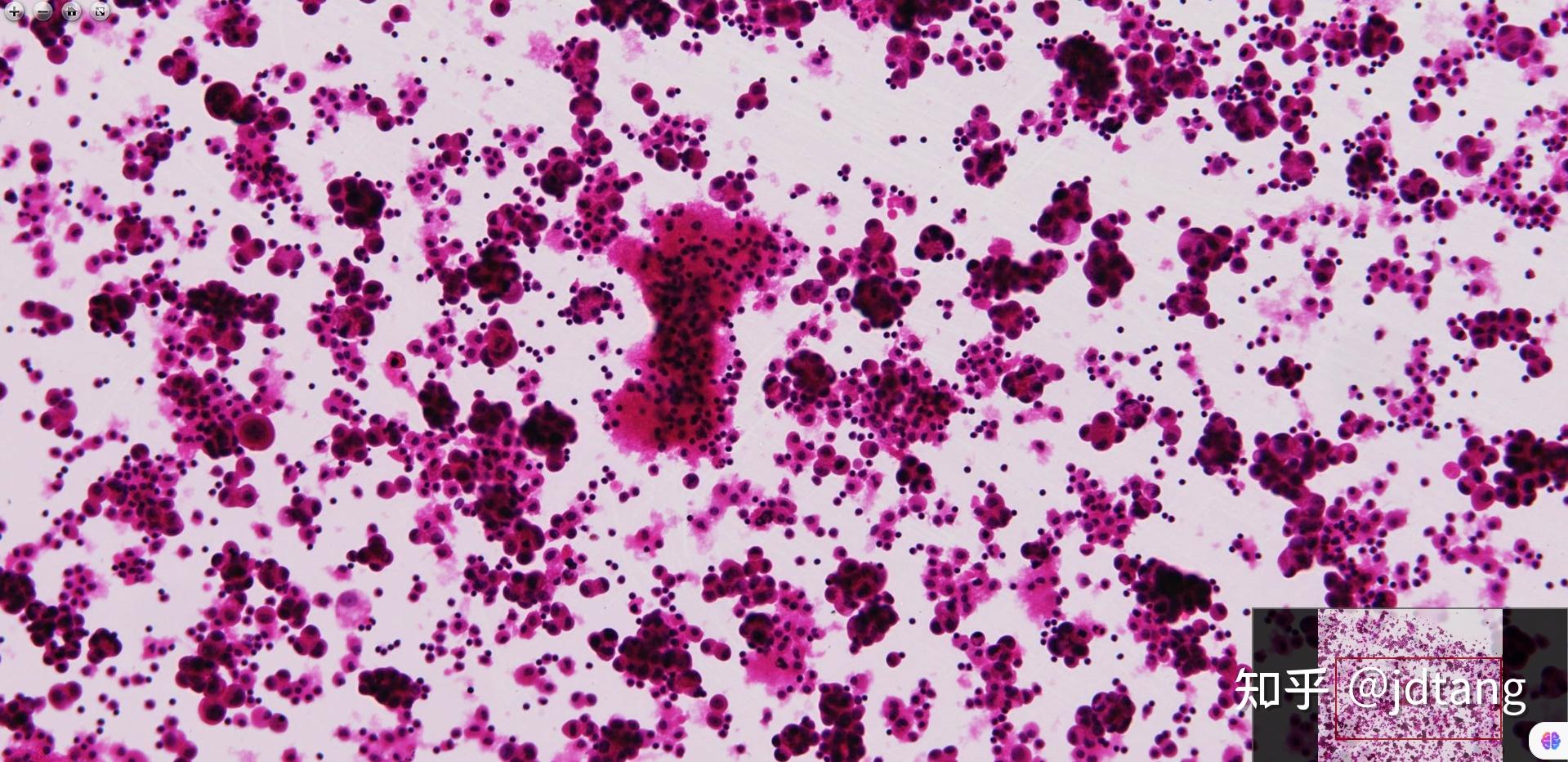 openseadragon usage + dzi +libvips - 知乎