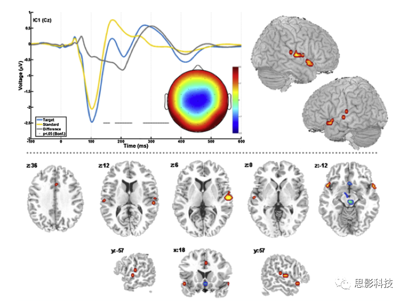 ICA在fMRI组水平推断和融合多模态数据方面的应用 - 知乎