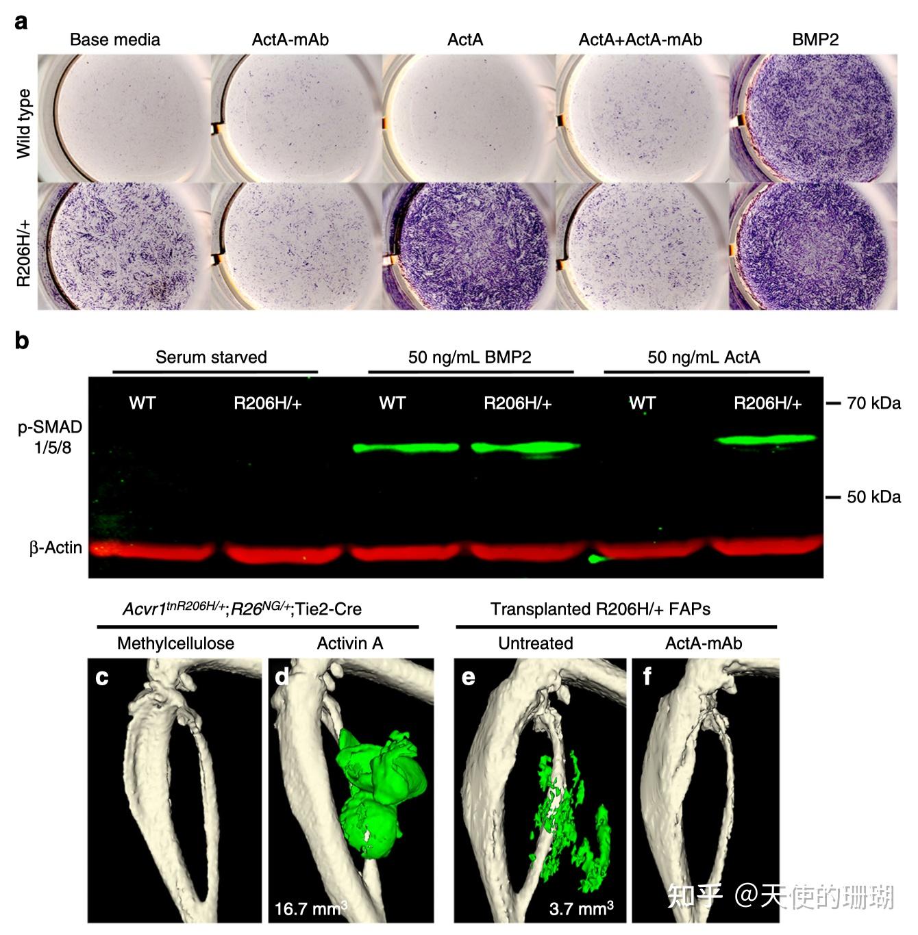 纤维成脂祖细胞中的激活素依赖性信号导致了FOP - 知乎