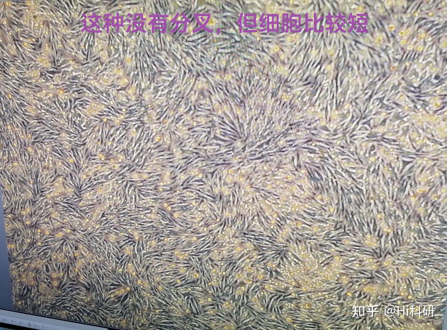 BMDM小鼠骨髓源性原代细胞培养 生物实验 研究生 - 知乎