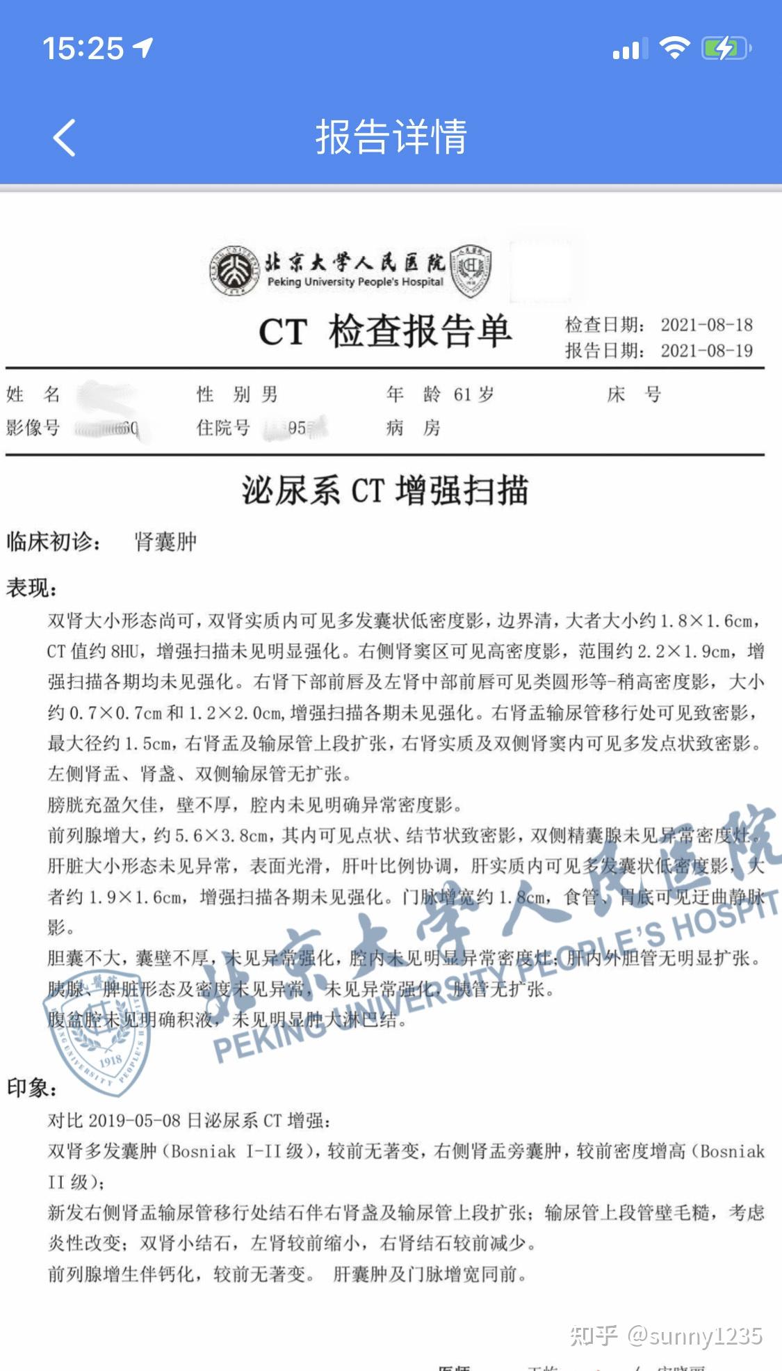 解读泌尿系CT检查报告 - 知乎