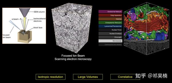 光镜电镜成像领域世界级大佬-Jennifer Lippincott Schwartz - 知乎