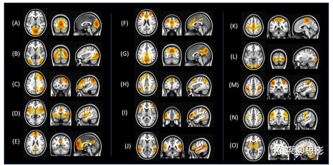 静息态fMRI的当前方法和新方向 - 知乎