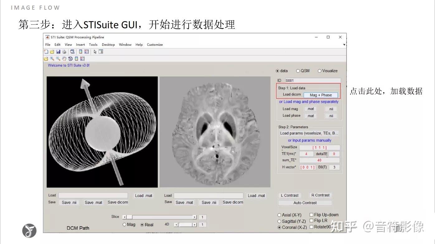 定量磁敏感成像（QSM）数据处理教程 - 知乎