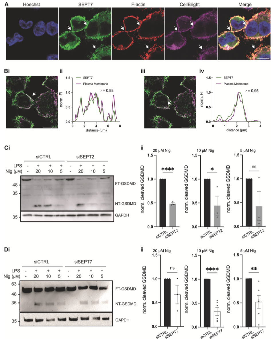 Cell Chemical Biology丨Septins通过调节GSDMD和NINJ1介导的细胞膜破裂来促进巨噬细胞的焦亡 - 知乎