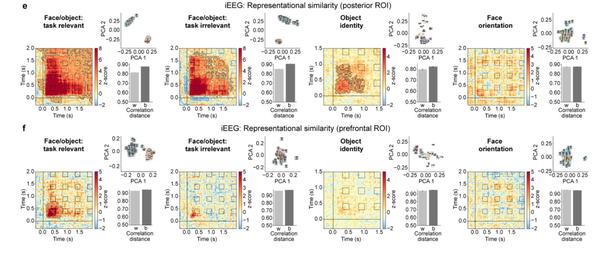 IIT vs GNWT：意识理论对比检验 - 知乎