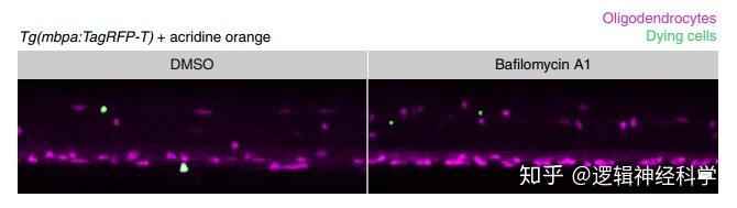 解析Nat Neurosci︱前沿! 小胶质细胞吞噬髓鞘并修饰髓鞘发育 - 知乎