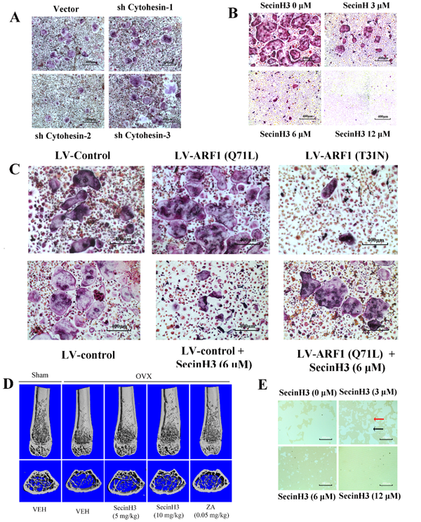 Pharmacol Res︱李锋/关邯峰课题组揭示Cytohesin-2/ARF1调控破骨细胞分化和影响骨质疏松发生发展的机制 - 知乎