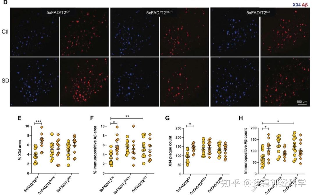 STM︱华盛顿大学科研团队发现睡眠不足促进小胶质活化和Aβ沉积依赖于TREM2 - 知乎