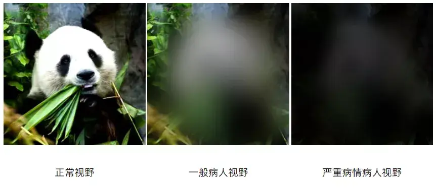 十年磨一剑 | 中国首个获得FDA临床试验许可的眼科体内基因治疗药物 - 知乎