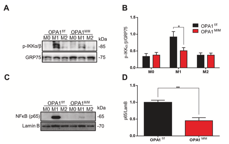 CDD丨OPA1 通过 p65 信号驱动巨噬细胞代谢和功能承诺 - 知乎