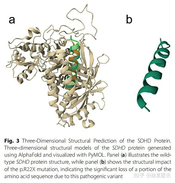 WES检测发现致病性SDHD突变，破解家族遗传性头颈部副神经节瘤病因 - 知乎