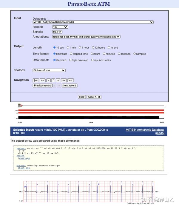 基于深度学习的ECG分类(二)——数据集合并及数据预处理 - 知乎