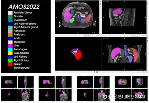 AMOS 2022 数据集介绍 - 知乎