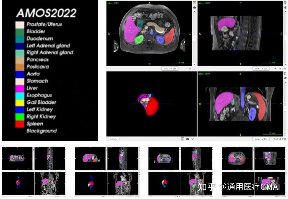AMOS 2022 数据集介绍 - 知乎