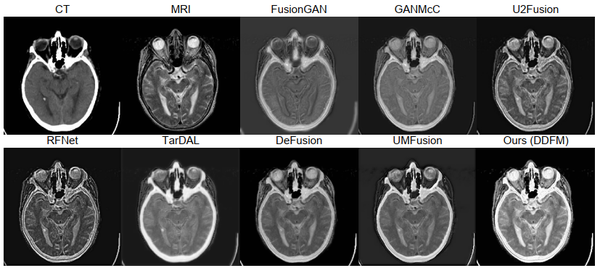 ICCV 2023 Oral：DDFM——首个使用扩散模型进行多模态图像融合的方法 - 知乎