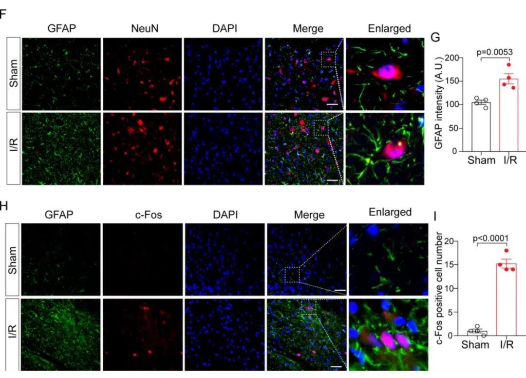 IF=12.416【客户文章】安徽医科大学第二附属医院张野/何淑芳团队揭示脊髓星形胶质细胞在心肌缺血损伤中的作用机制 - 知乎