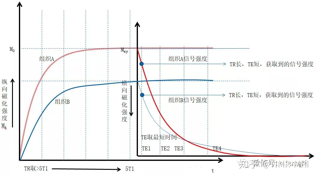 磁共振成像：对PDW T1W T2W 三种加权图像的理解 - 知乎