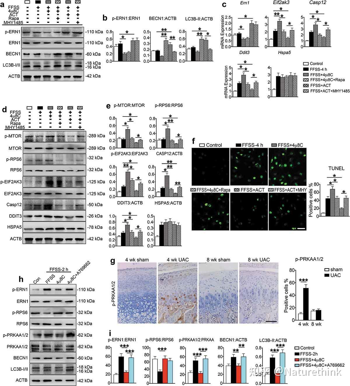 MTORC1协调骨关节炎颞下颌关节软骨细胞的自噬与凋亡信号 - 知乎