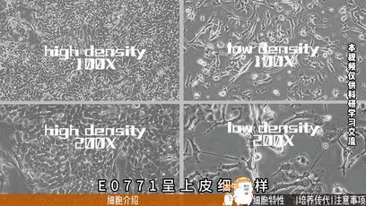 E0771细胞培养，小鼠髓样乳腺癌细胞培养攻略 - 丰晖生物 - 知乎