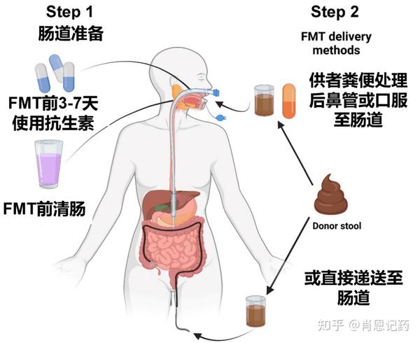 如何记住所有FDA批准生物药？| 中和艰难梭菌毒素B | Bezlotoxumab 贝洛托单抗 | 治疗艰难梭菌感染 - 知乎