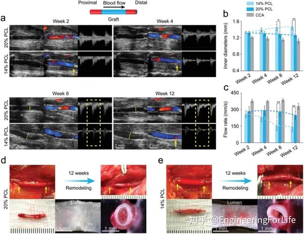 Small： PGS-PCL复合人工血管用于颈总动脉移植 - 知乎