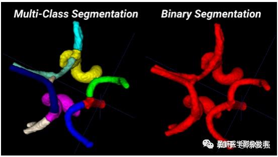 Top_Cow 2023——用于CTA和MRA的Willis环的拓扑解剖结构分割 - 知乎