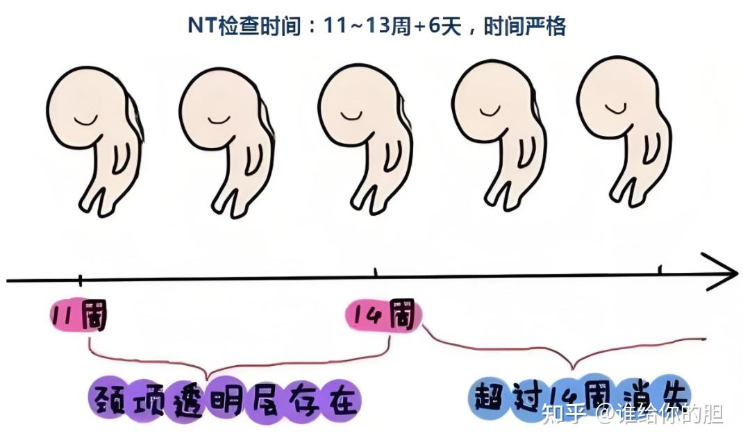 NT检查有什么作用，可以检查出哪些指标？ - 知乎