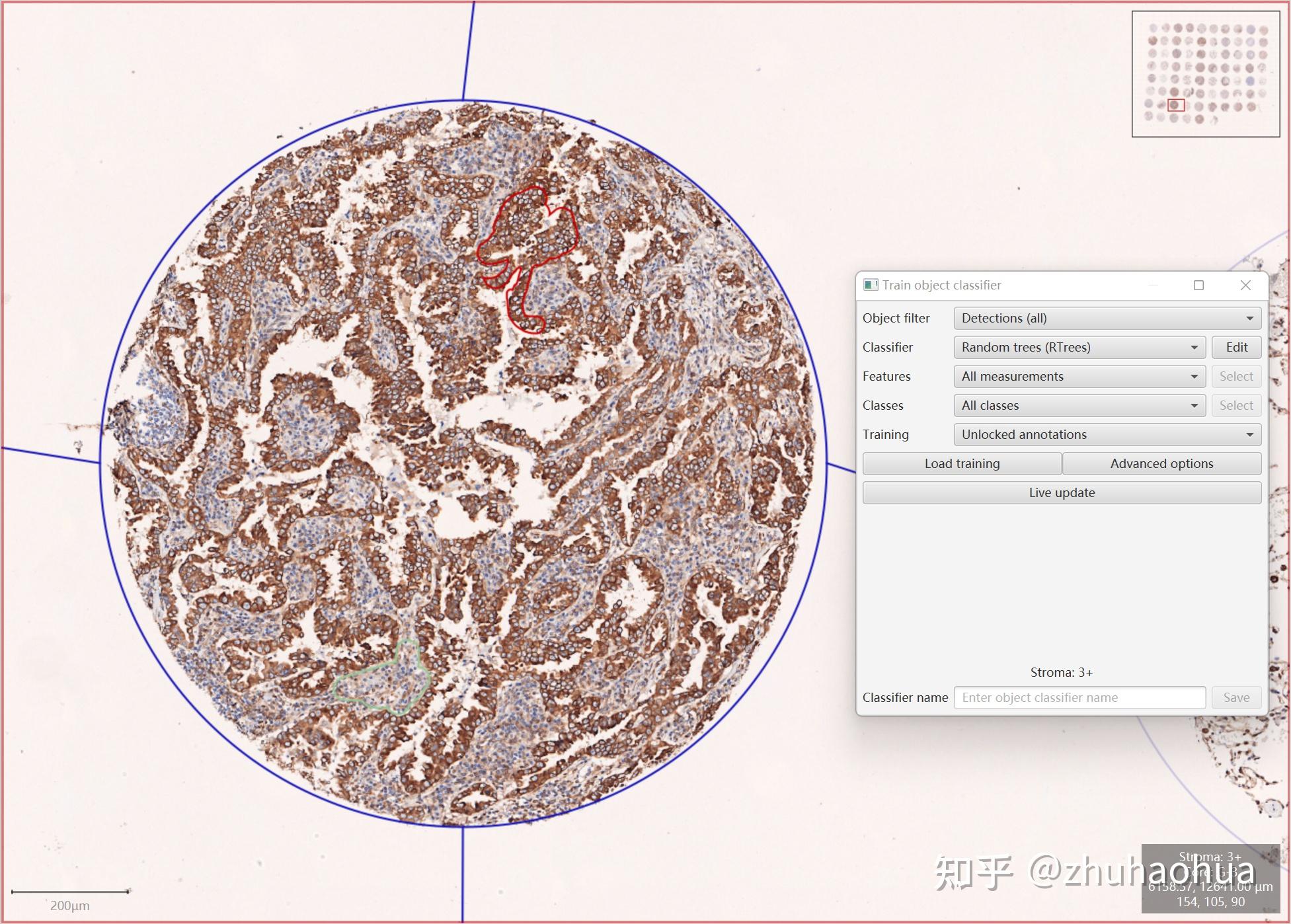 【笔记】QuPath用于免疫组化定量评估 - 知乎