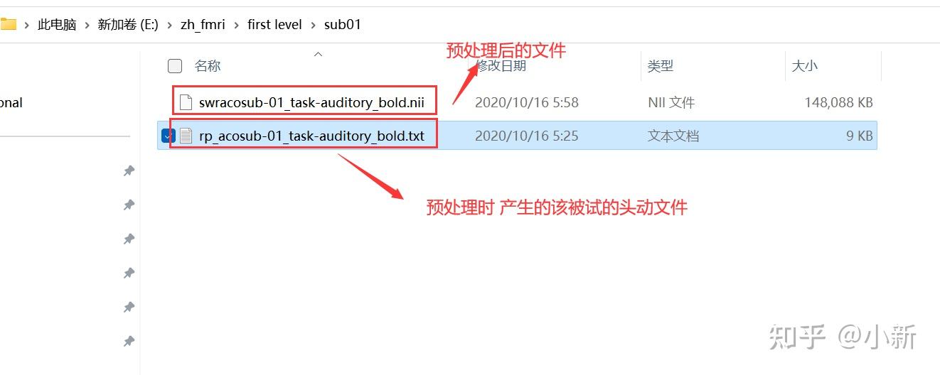 5-SPM-fmri任务态数据 一阶分析(单个被试） - 知乎