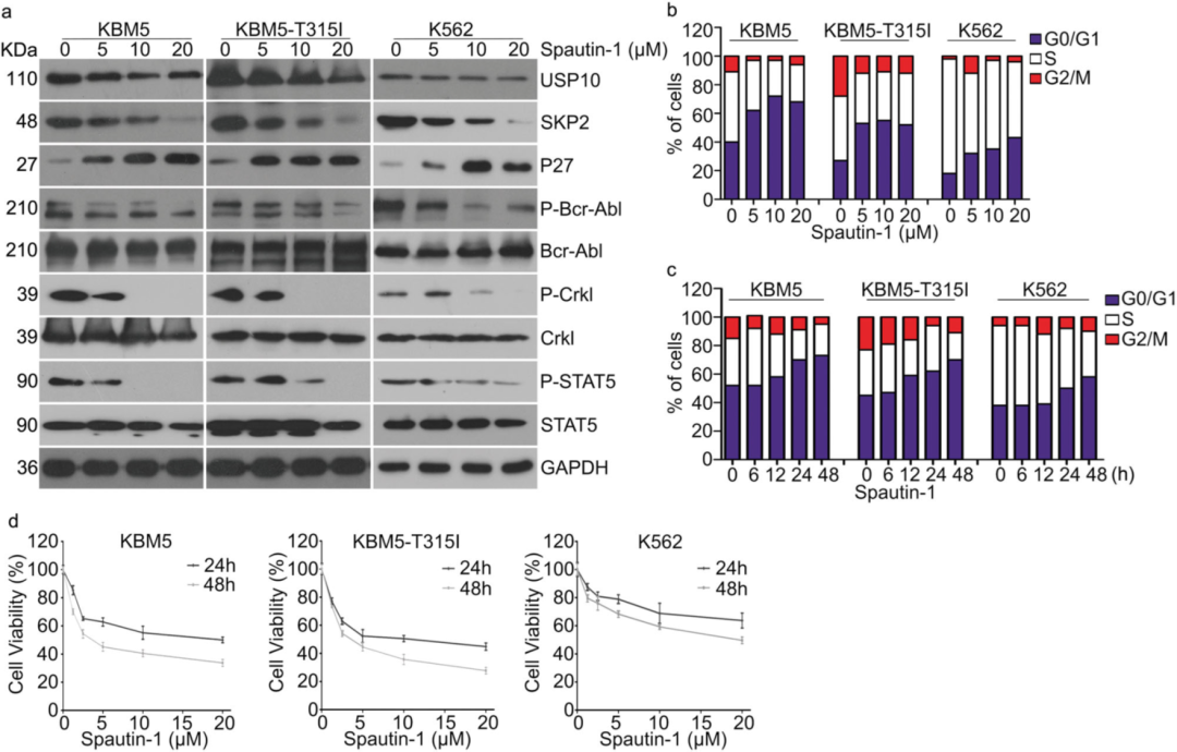 USP10通过稳定慢性粒细胞白血病中的SKP2来调节SKP2/Bcr-Abl轴 - 知乎
