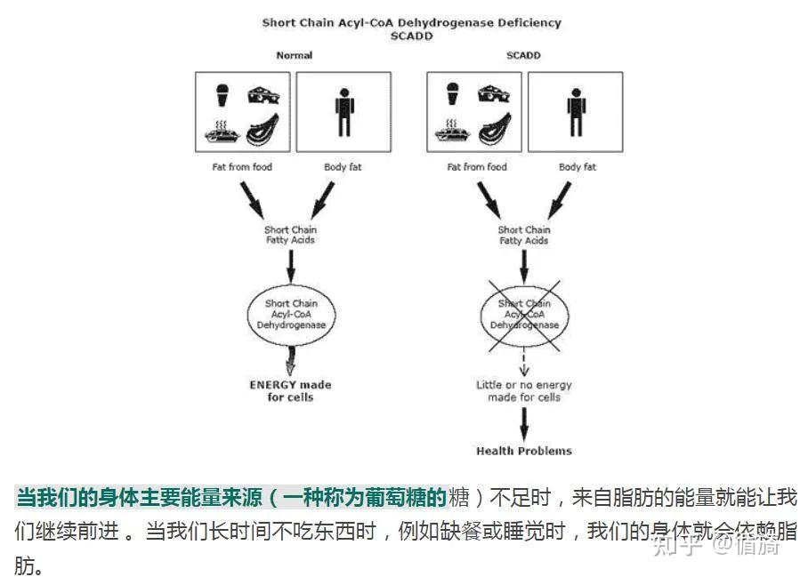 SCADD短链酰基辅酶A脱氢酶缺乏症引起发育迟缓和低血糖的脂肪酸氧化障碍的线粒体疾病 - 知乎