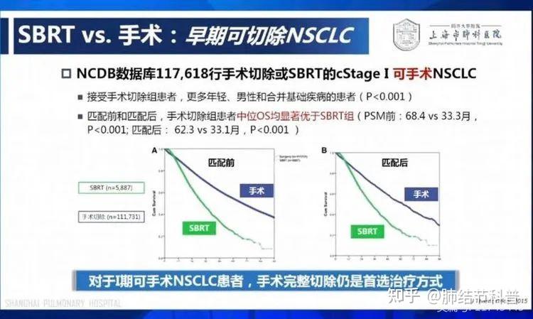早期非小细胞肺癌治疗综述：肺叶、肺段切除及SBRT、消融术 - 知乎