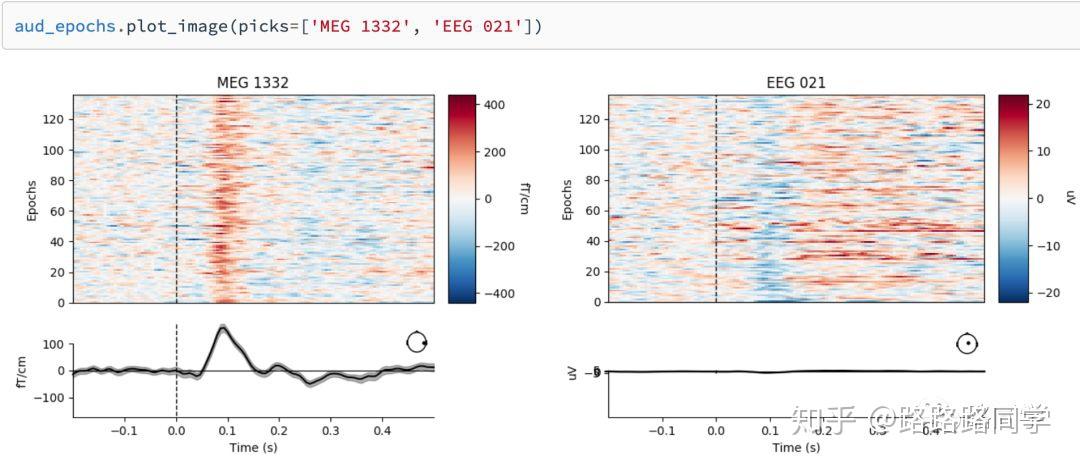 MNE-Python简易中文教程 | Part02 EEG/MEG数据分段与时频分析 - 知乎