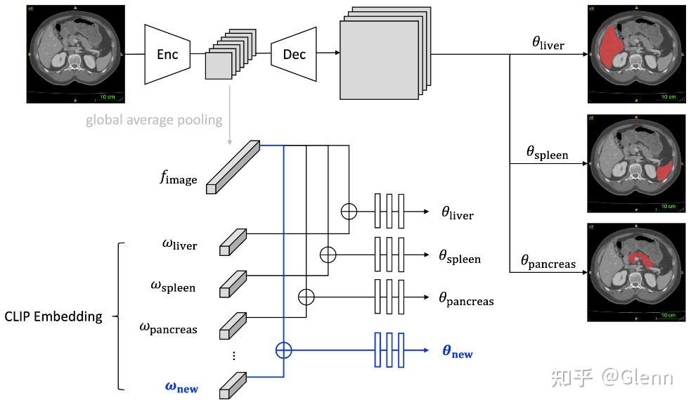 [论文阅读][MICCAI'23] MedSeg | 腹部多器官和肿瘤分割的增量学习 - 知乎