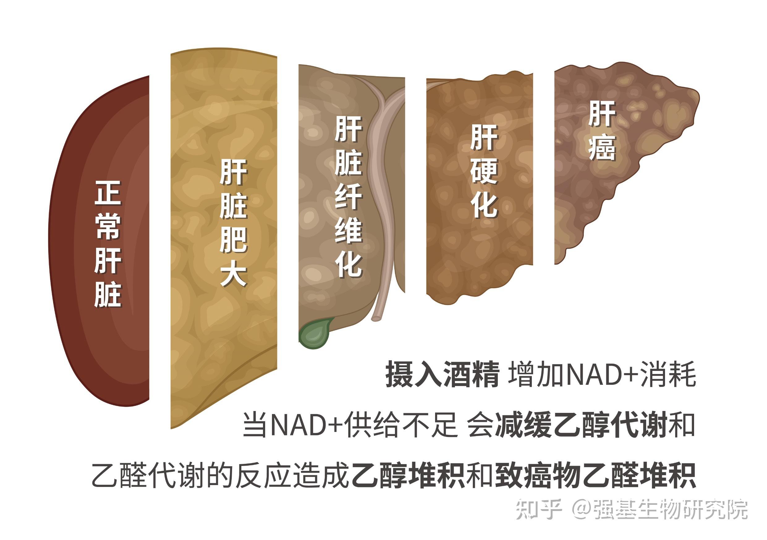 应酬 酒精肝”怎么办?nad解锁 解酒保肝”新指南 知乎