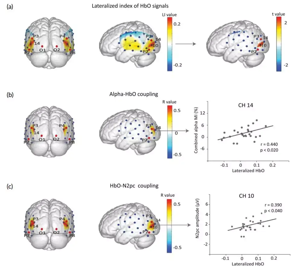 EEG和fNIRS同步联合，揭示预期对于注意选择影响的神经机制 - 知乎